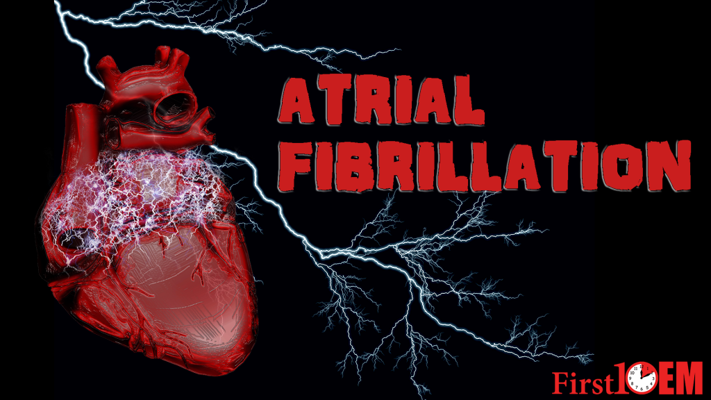 Management of atrial fibrillation emergency medicine First10EM - First10EM
