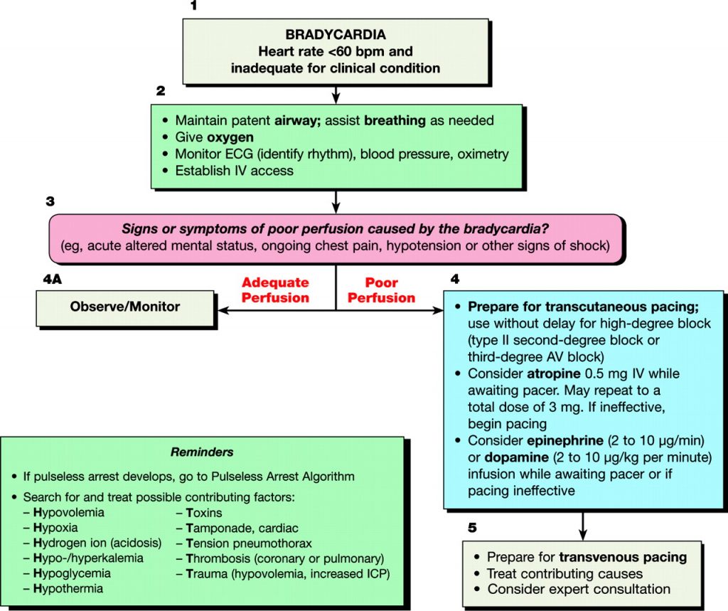 Managing unstable bradycardia - First10EM