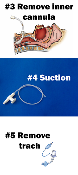 Respiratory distress in the patient with a tracheostomy (update ...