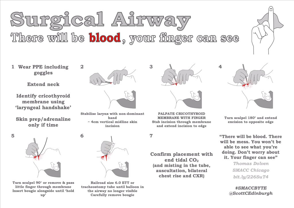 Emergency Airway Management Part 4: Cricothyroidotomy (surgical front ...