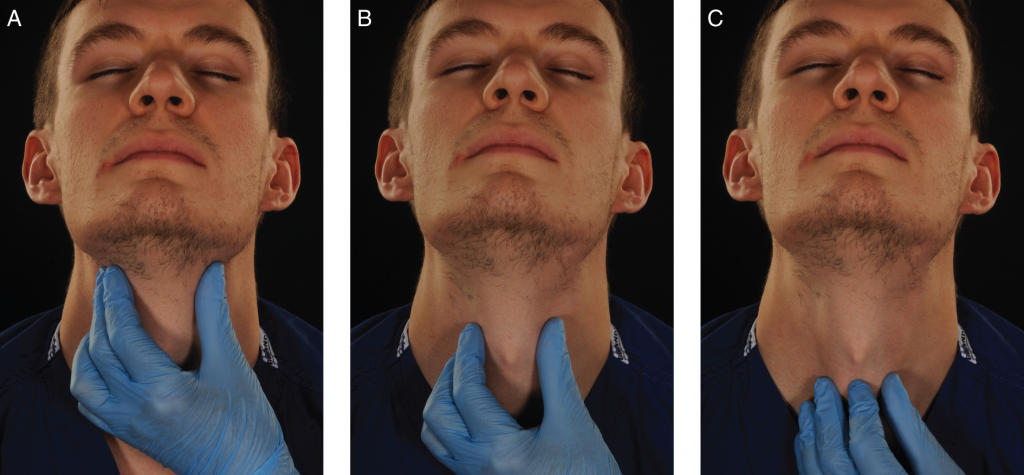 Emergency Airway Management Part 4: Cricothyroidotomy (surgical front ...