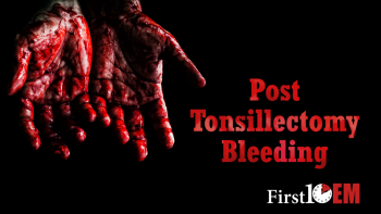 Massive Hemorrhage Post-Tonsillectomy - First10EM