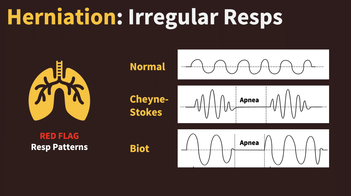 The Crashing Brain: Approach to the first 10 minutes - First10EM