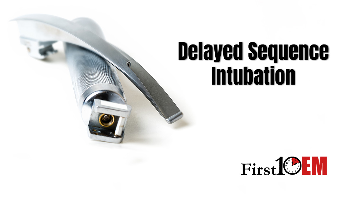 Management of intermediate and high risk pulmonary embolism (aka ...